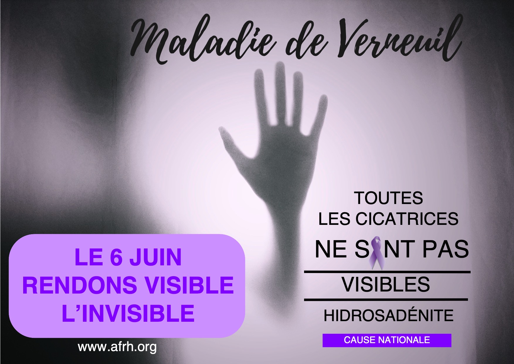 Actualités | Vaincre Verneuil